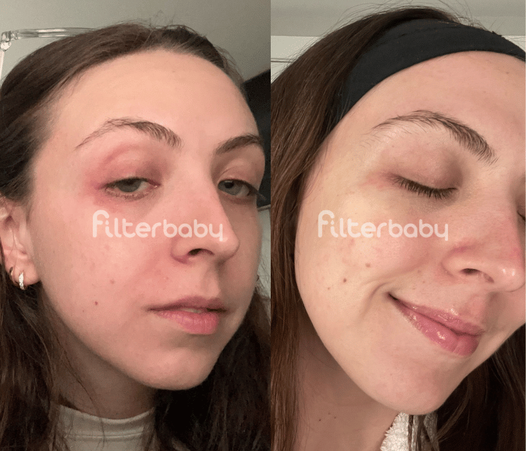 Filterbaby Skincare Faucet Filter 2.0 – FilterBaby