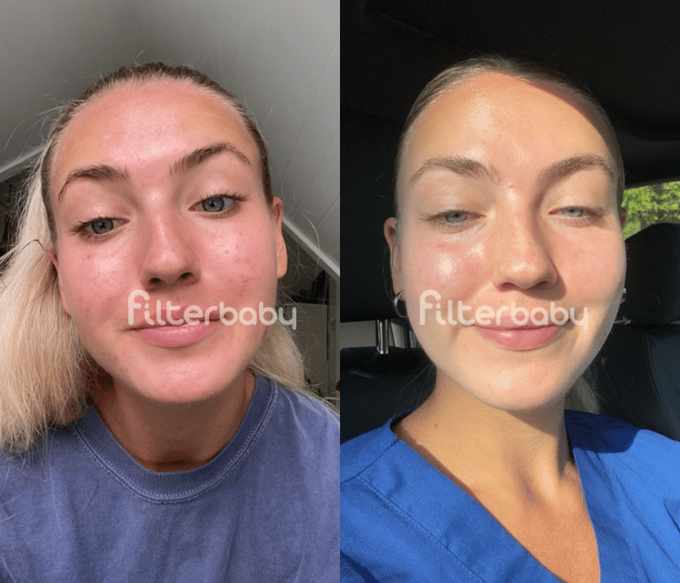 Filterbaby Skincare Filter Replacement 2.0 – FilterBaby