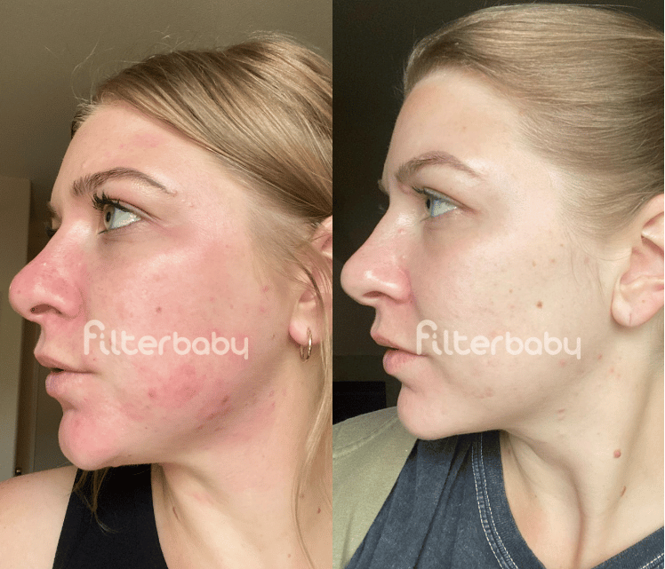 Filterbaby Skincare Faucet Filter 2.0 – FilterBaby