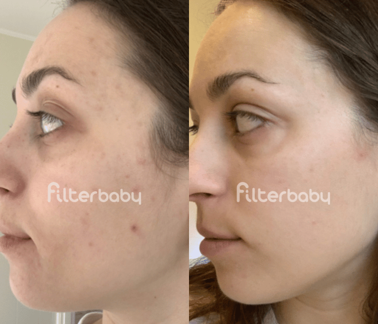 Filterbaby Skincare Filter Replacement 2.0 (4-Pack) – FilterBaby