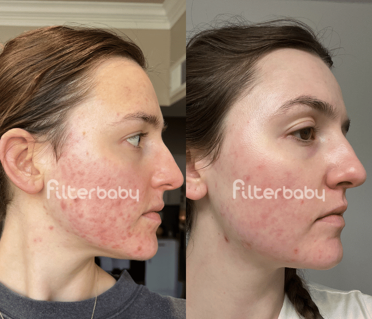 Filterbaby Skincare Filter Replacement 2.0 – FilterBaby