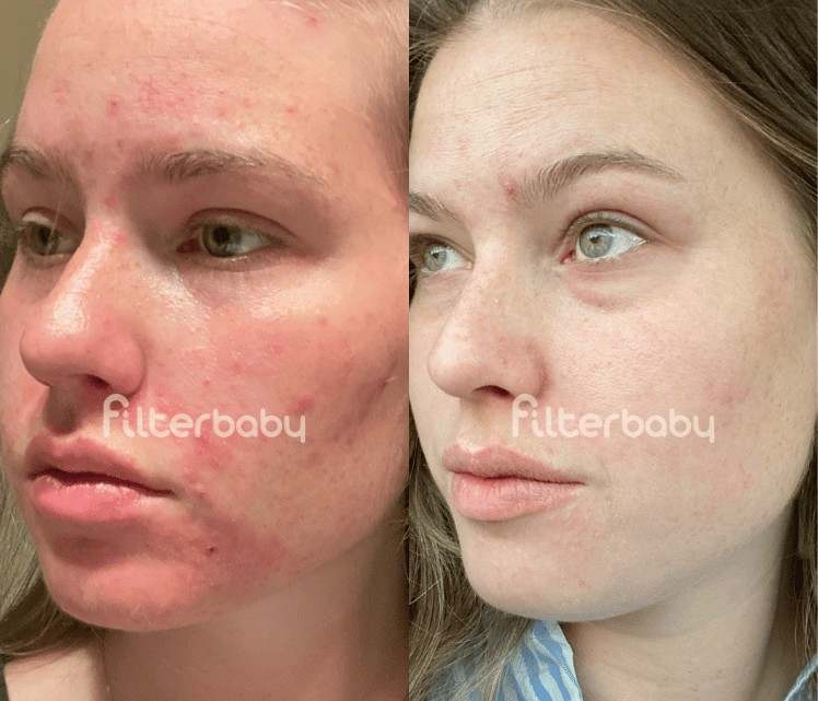 Filterbaby Skincare Filter Replacement 2.0 – FilterBaby